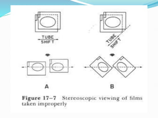 Stereography 1234.pptx