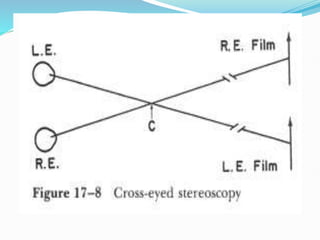 Stereography 1234.pptx