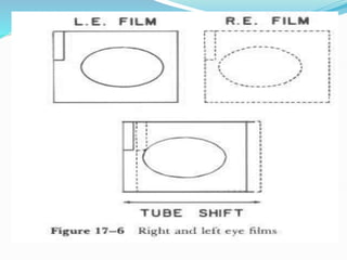 Stereography 1234.pptx | 3-D Graphics | Computer Software and Applications