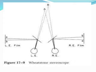 Stereography 1234.pptx