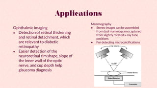 Stereoscopy in Dentistry | PPTX | 3-D Graphics | Computer Software and ...
