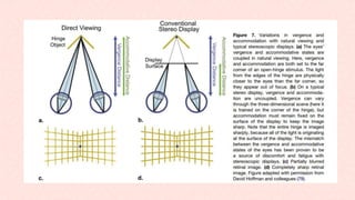 Stereoscopy in Dentistry | PPTX | 3-D Graphics | Computer Software and ...