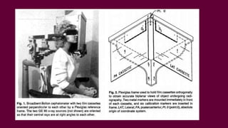 Stereoscopy in Dentistry | PPTX | 3-D Graphics | Computer Software and ...
