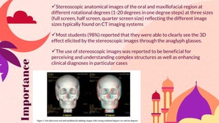 Stereoscopy in Dentistry | PPTX