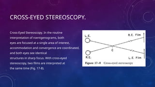 STEREOSCOPY in the field of radiography.pptx