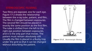 STEREOSCOPY in the field of radiography.pptx