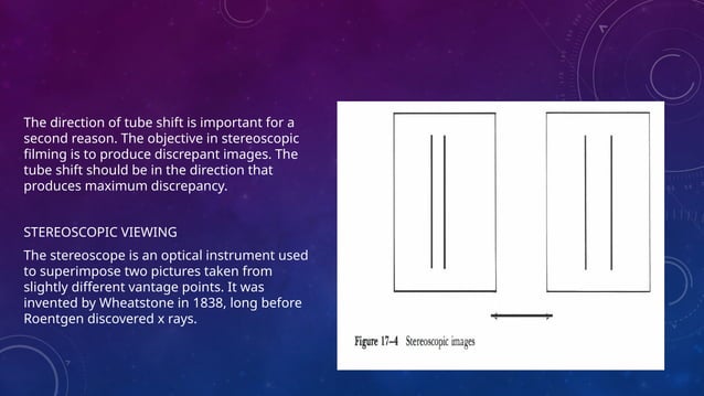 STEREOSCOPY in the field of radiography.pptx | Cameras and Camcorders ...