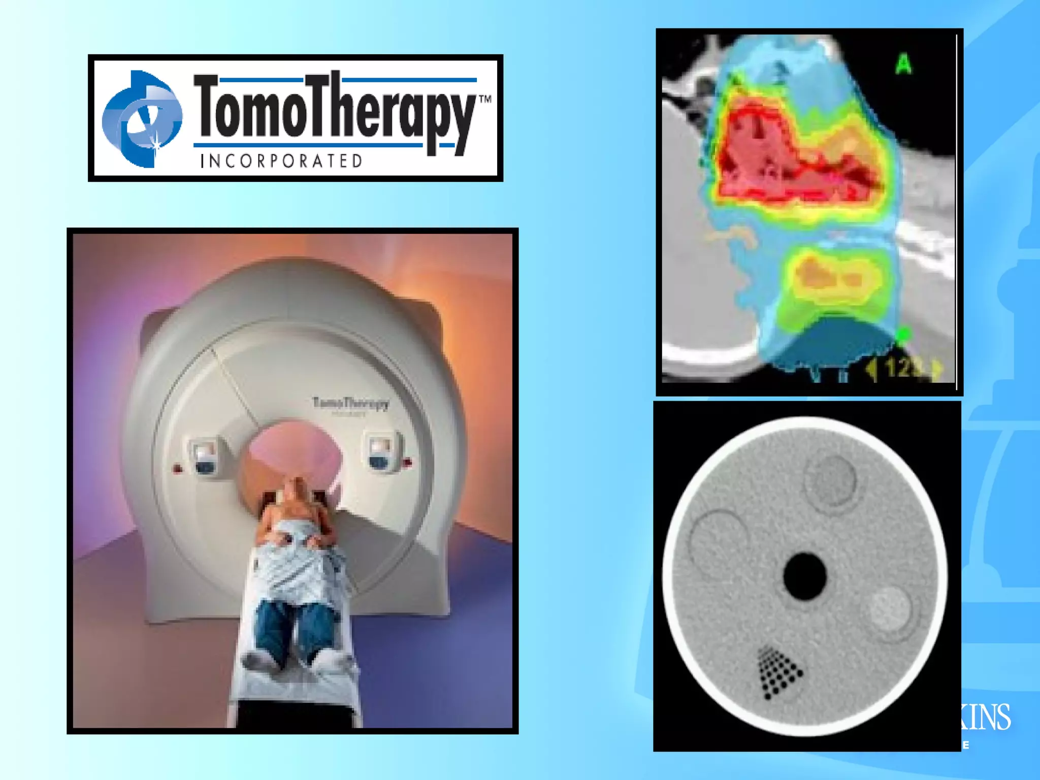 Stereotactic Body Radiation Therapy | PPT Stereotactic Body Radiation Therapy | PPT
