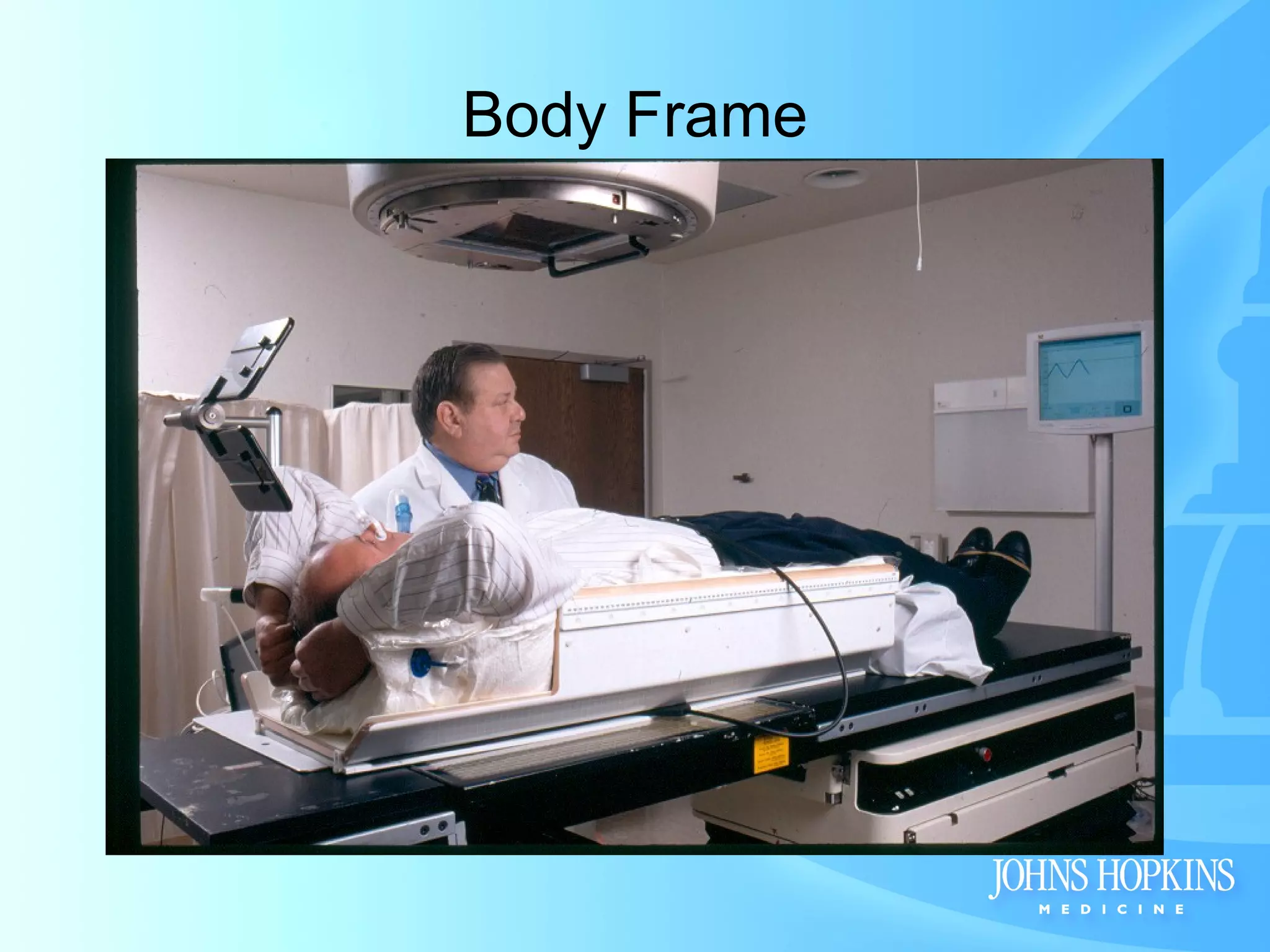 Stereotactic Body Radiation Therapy | PPT