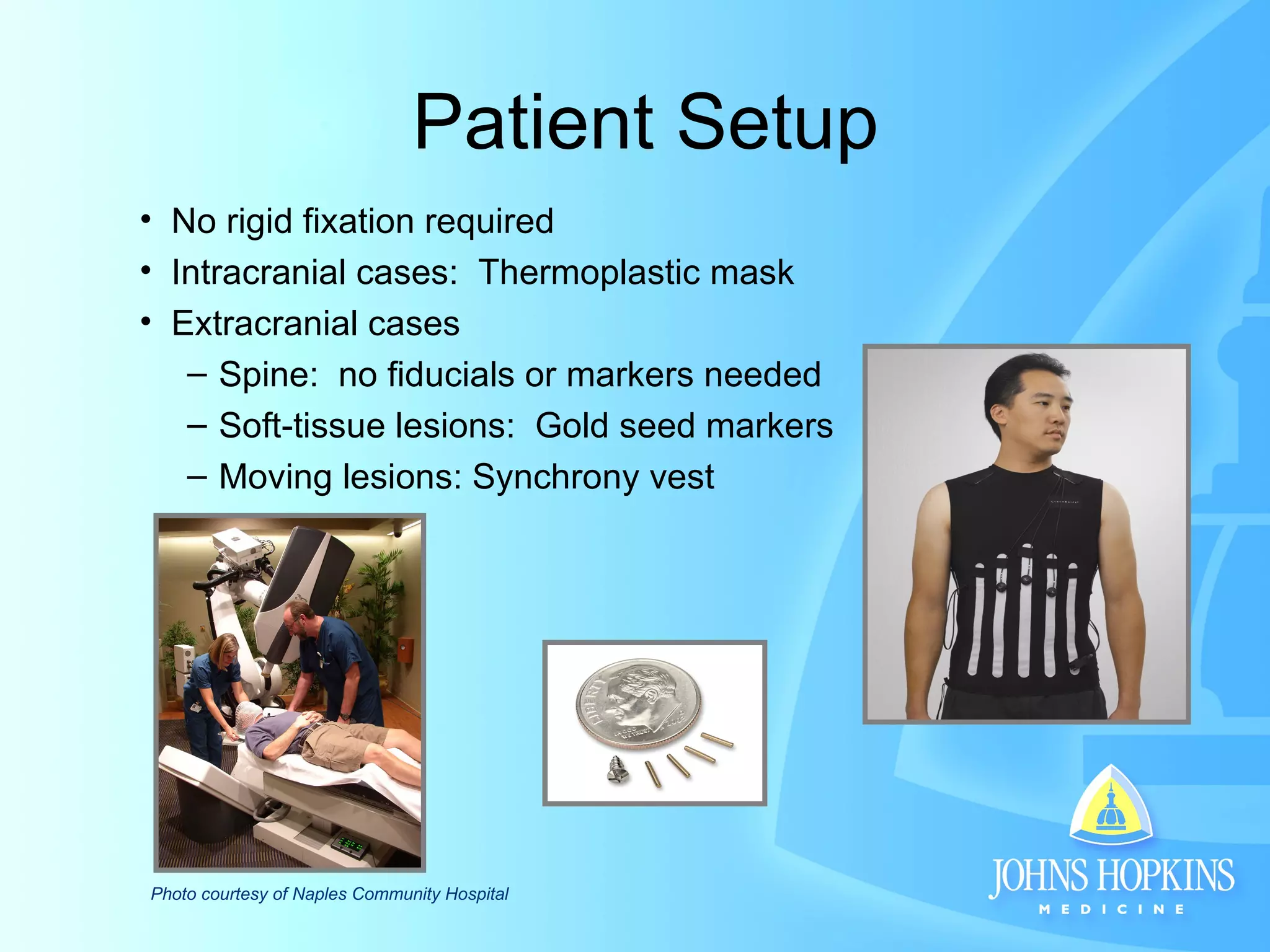 Stereotactic Body Radiation Therapy | PPT Stereotactic Body Radiation Therapy | PPT