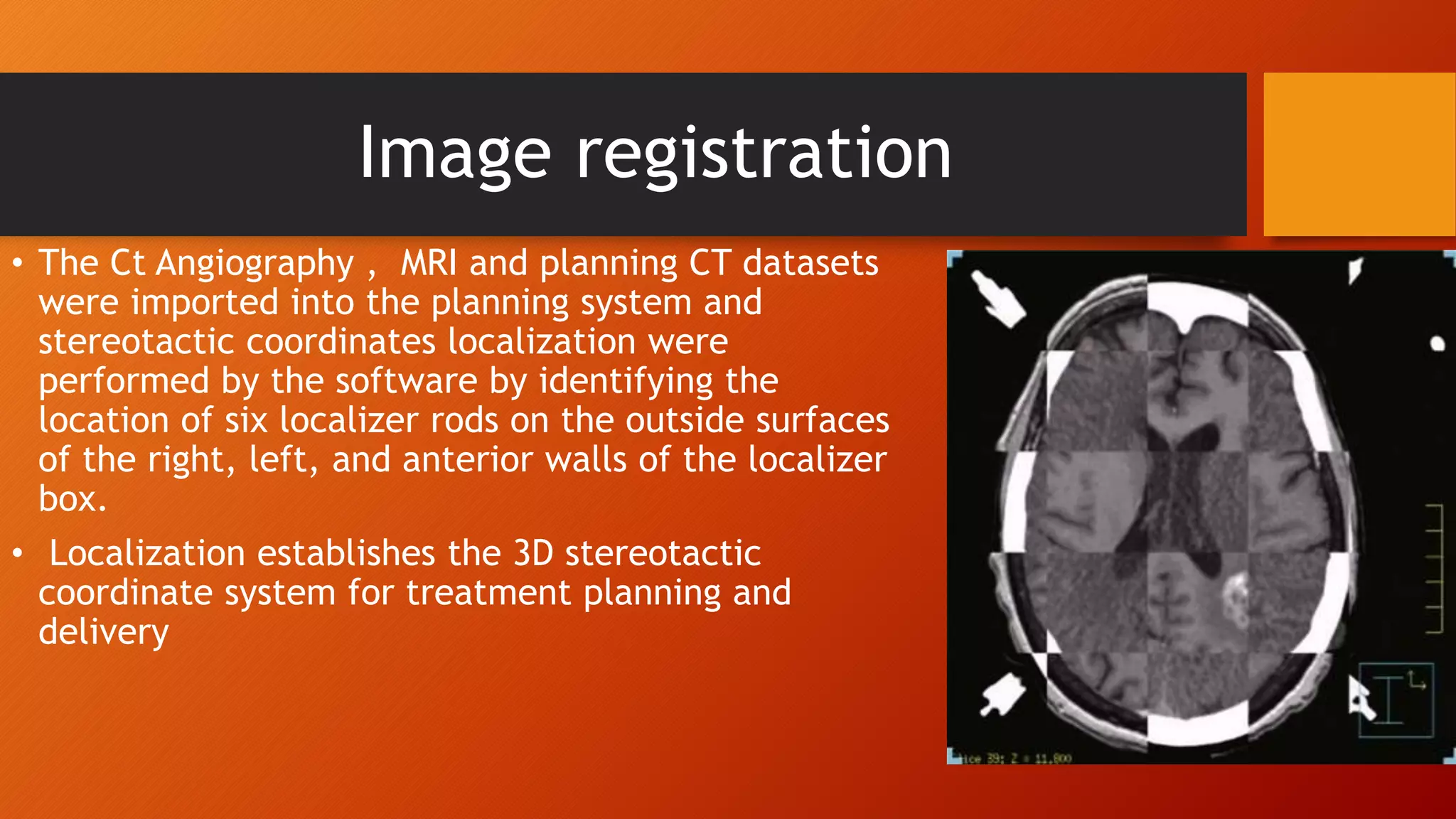 Stereotactic radiosurgery and radiotherapy | PPTX