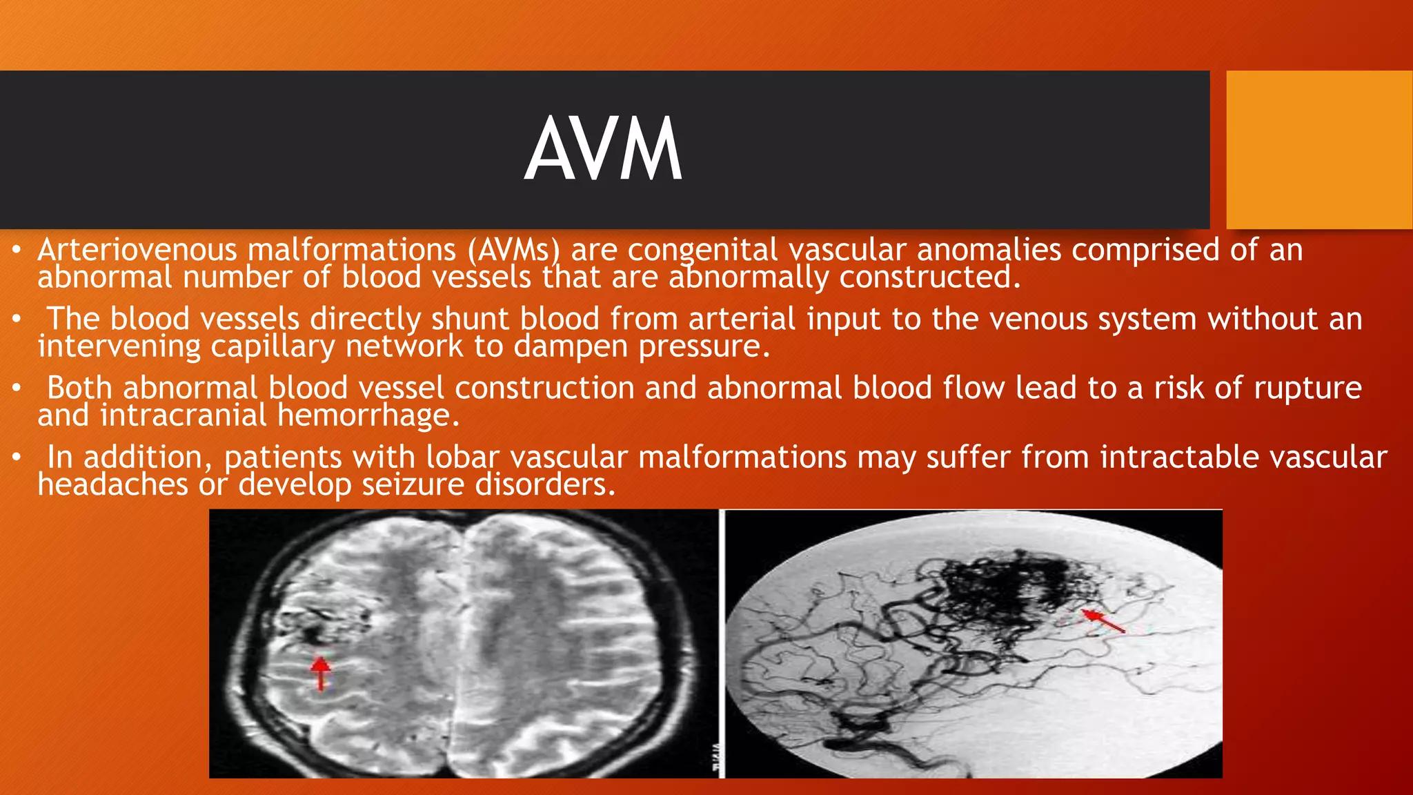 Stereotactic radiosurgery and radiotherapy | PPTX