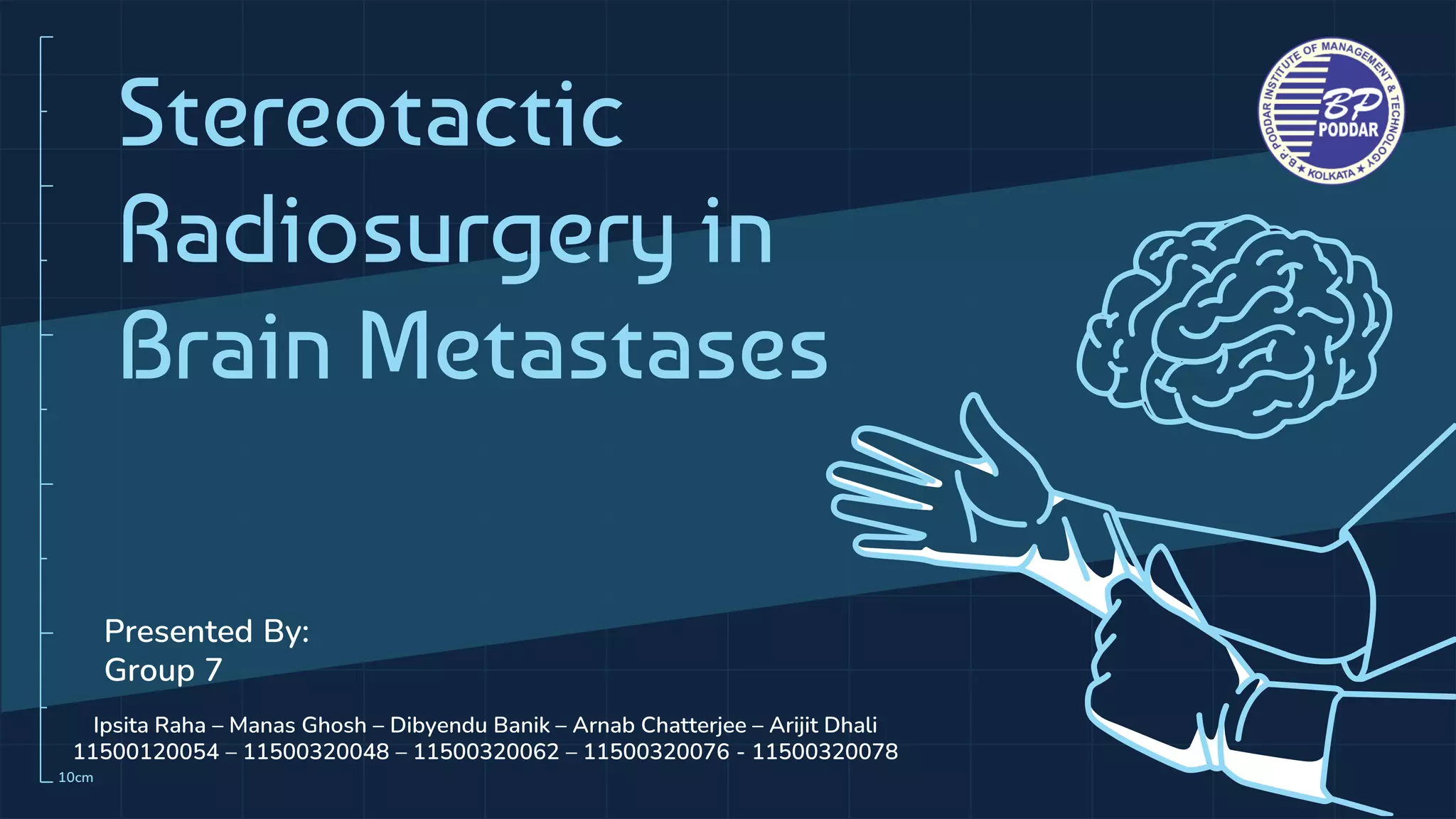 Stereotactic Radiosurgery in Brain Metastases.pdf