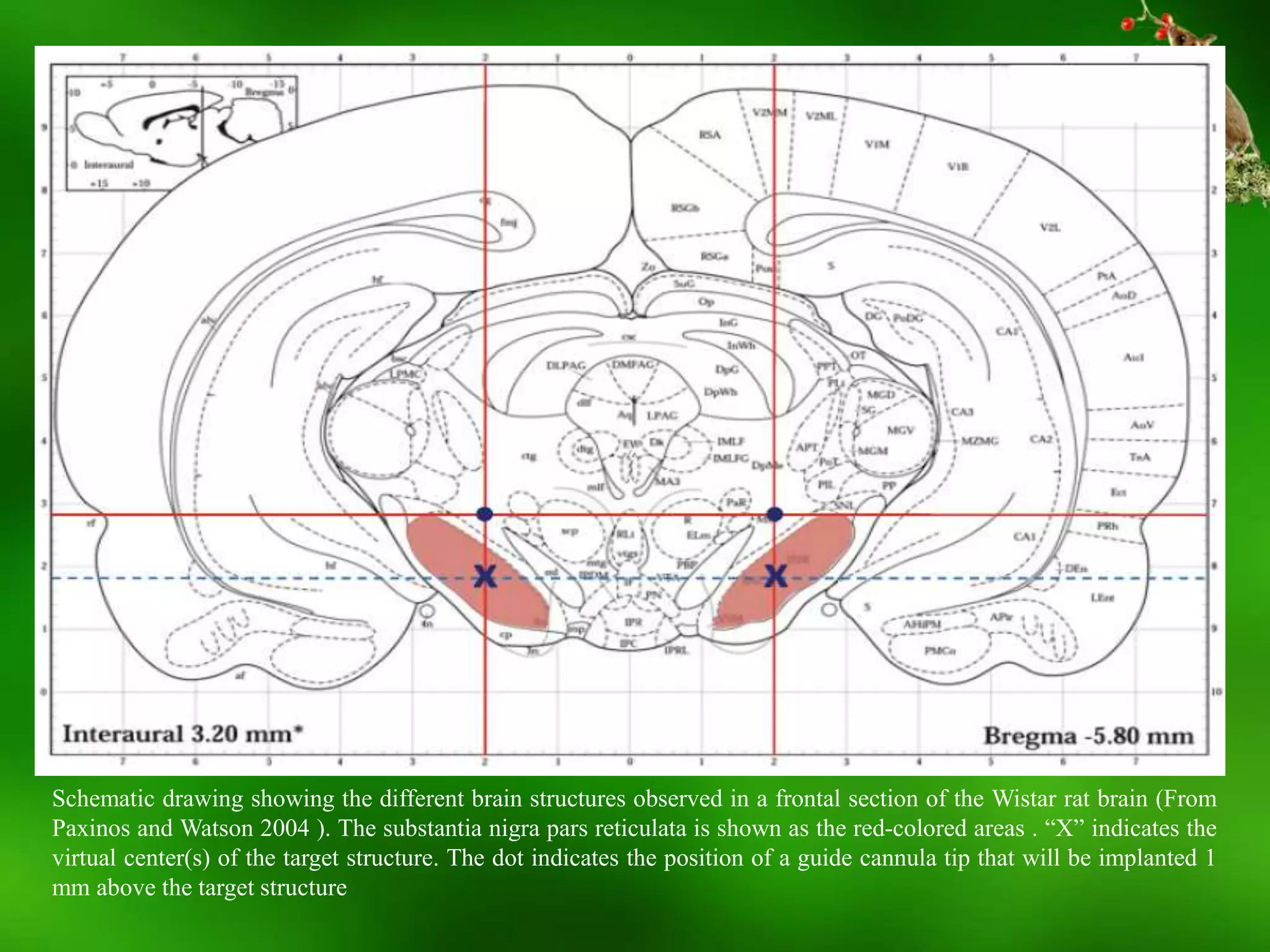 Stereotaxic atlas | PPTX