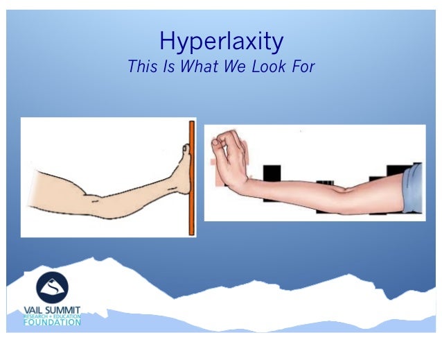 Women & Sports Injuries (Including ACL Tears in Female Athletes)