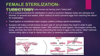 Sterilization | PPTX