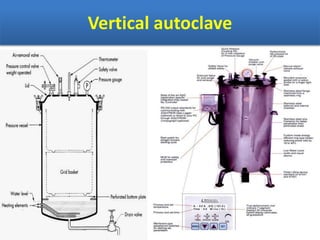 Autoclave Labelled Diagram