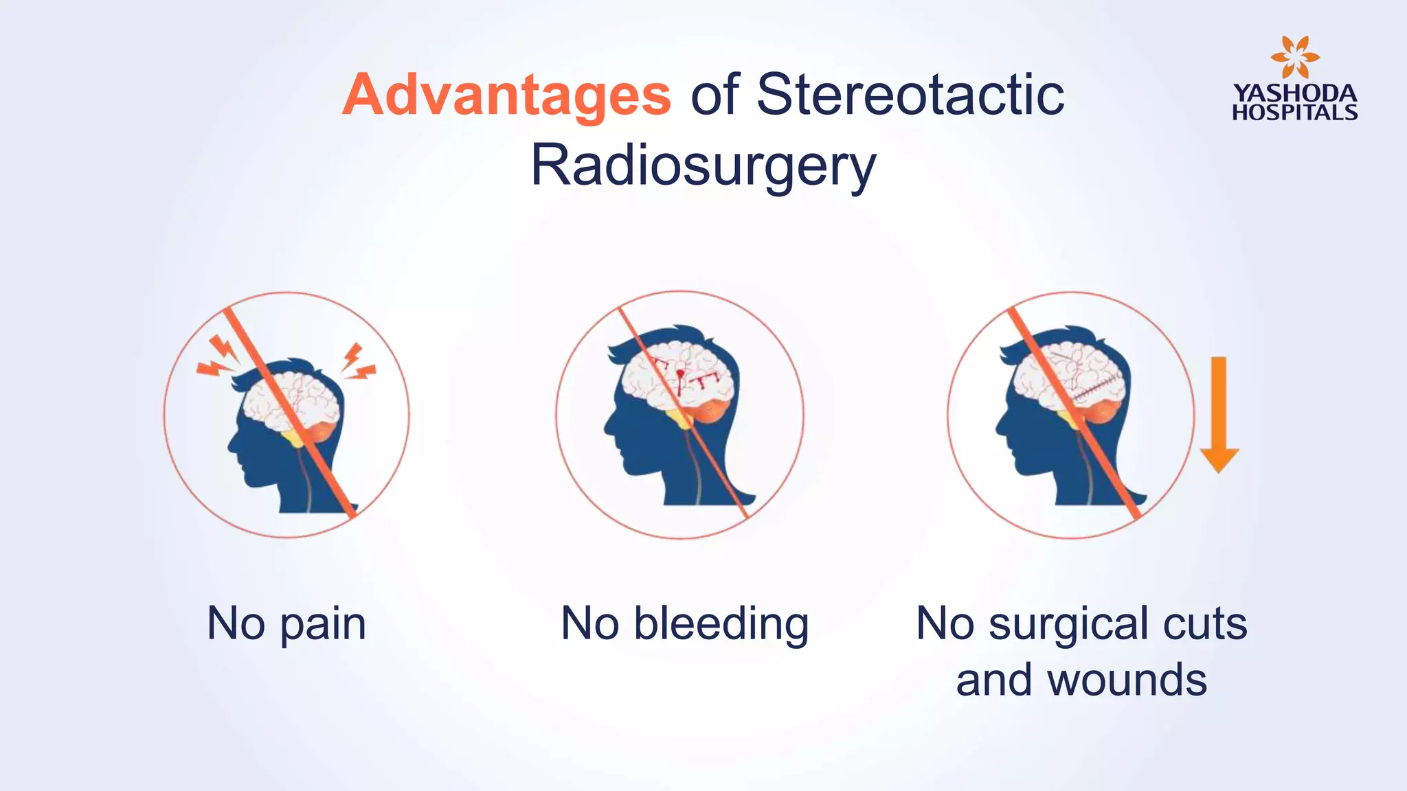 What Is Stereotactic Radiosurgery(SRS) | What Conditions Does It Treat ...