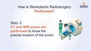 What Is Stereotactic Radiosurgery(SRS) | What Conditions Does It Treat ...