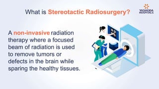 What Is Stereotactic Radiosurgery(SRS) | What Conditions Does It Treat? | PPTX | Surgery ...
