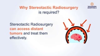 What Is Stereotactic Radiosurgery(SRS) | What Conditions Does It Treat? | PPTX | Surgery ...