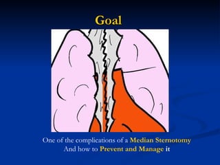 Sternal Dehiscence 10.5 | PPT