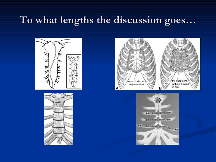 Sternal Dehiscence 10.5