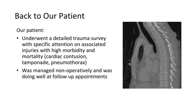 Sternal Fractures & Dislocations - EMGuidewire Radiology Reading Room ...
