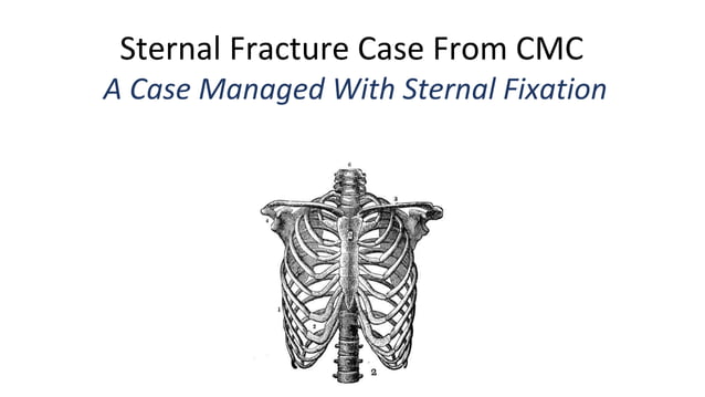 Sternal Fractures & Dislocations - EMGuidewire Radiology Reading Room ...