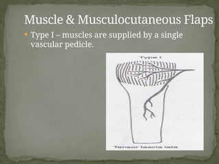 Sternocleidomastoid Muscle Flap in neck dissection.pptx