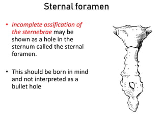 Sternum.pptx