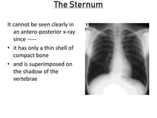 Sternum.pptx