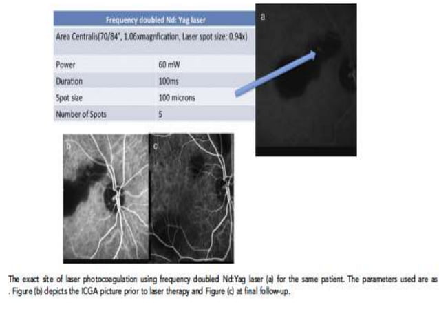 Steroid in IPCV BY DR.PUSHKAR DHIR.pptx