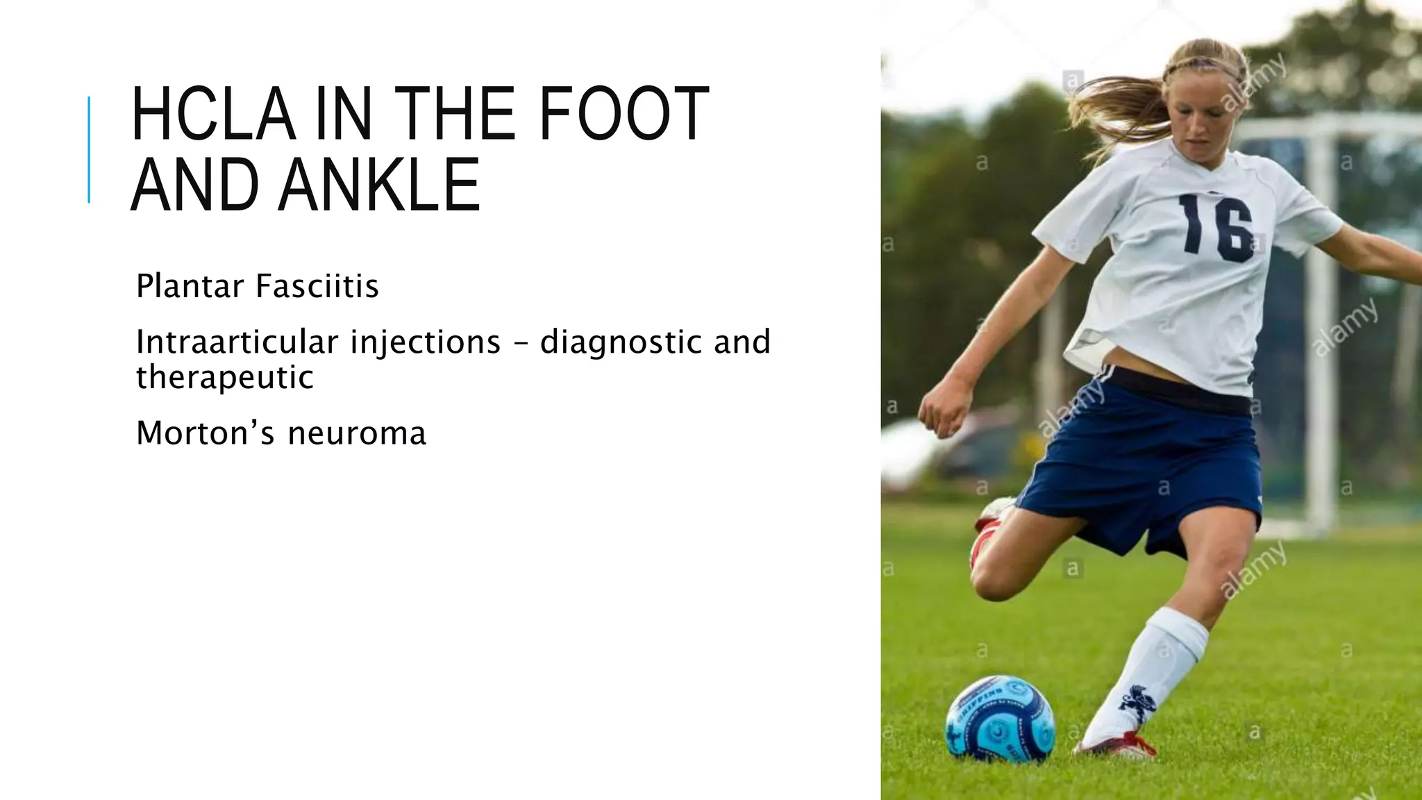 Steroid injections in the foot & ankle | PPTX