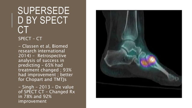 Steroid injections in the foot & ankle | PPTX | Foot Health | Diseases ...