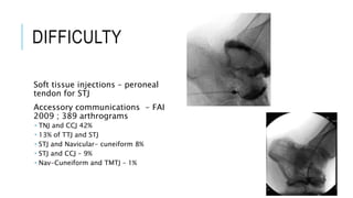 Steroid injections in the foot & ankle | PPTX