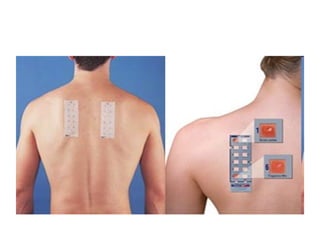 Steroid Project Snw | PPT