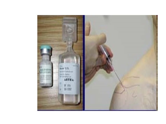 Steroid Project Snw | PPT