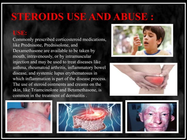 Steroids abuse and misuse | PPTX