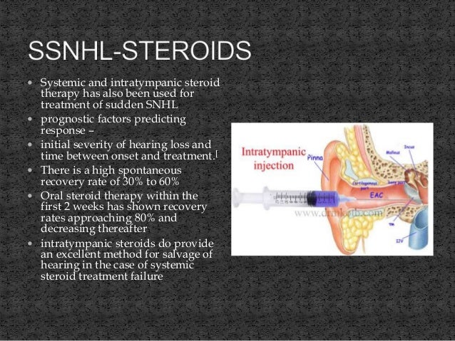 Steroids in SSNHL