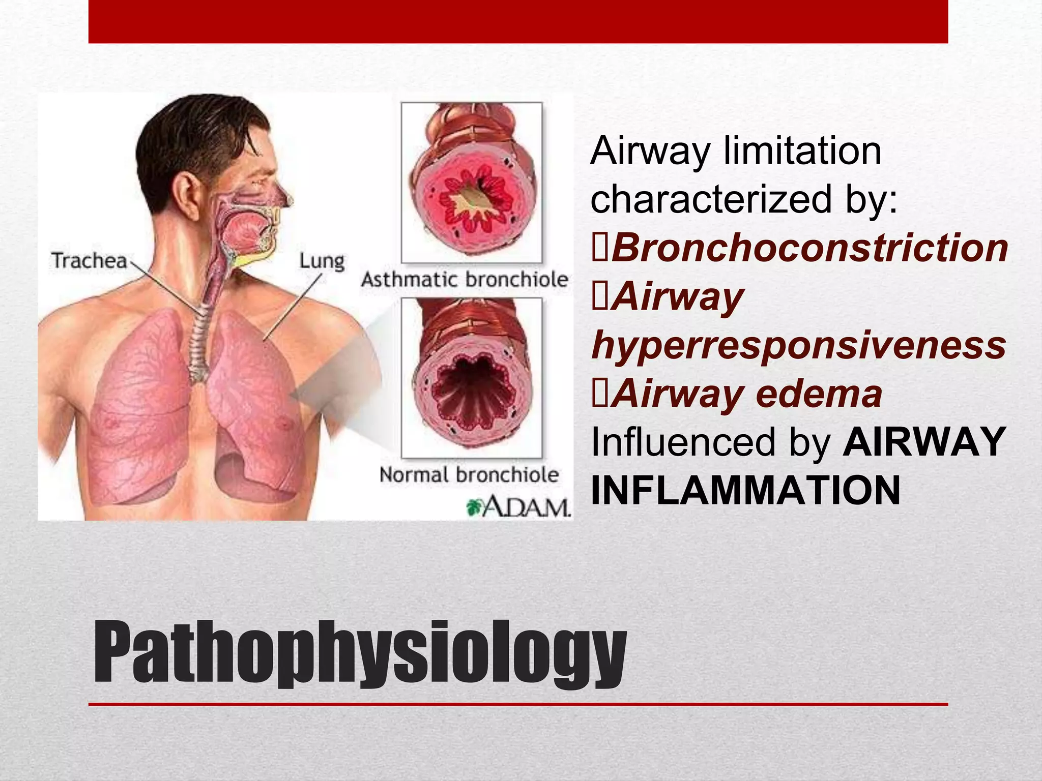 Steroids In obstructive airway disease | PPTX