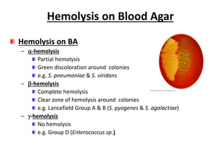 Sterptococcus | PPTX