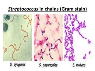 Sterptococcus | PPTX