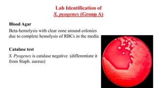 Streptococcus | PPTX