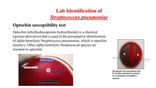 Streptococcus | PPTX