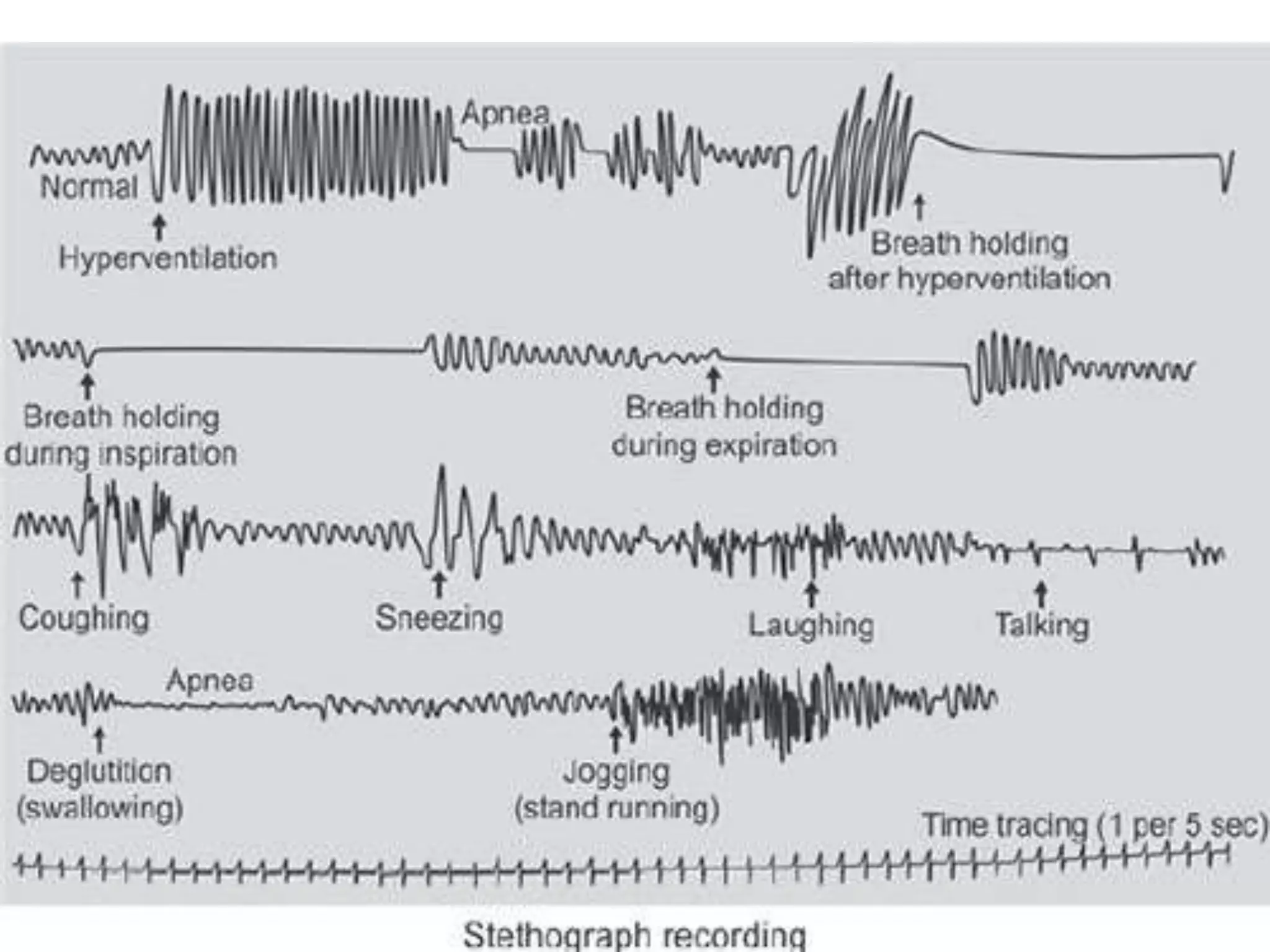 Stethograph- Recording Respiratory Movements | PPTX