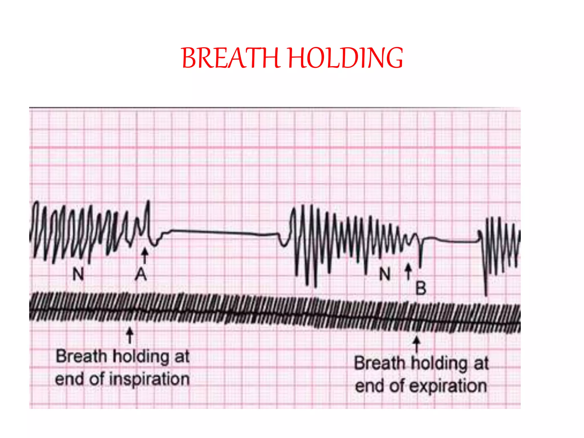 Stethograph- Recording Respiratory Movements | PPTX