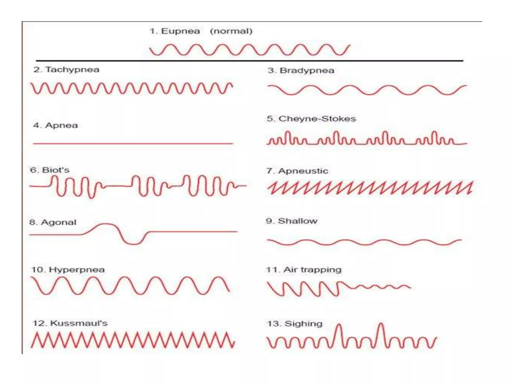 Stethograph- Recording Respiratory Movements | PPTX