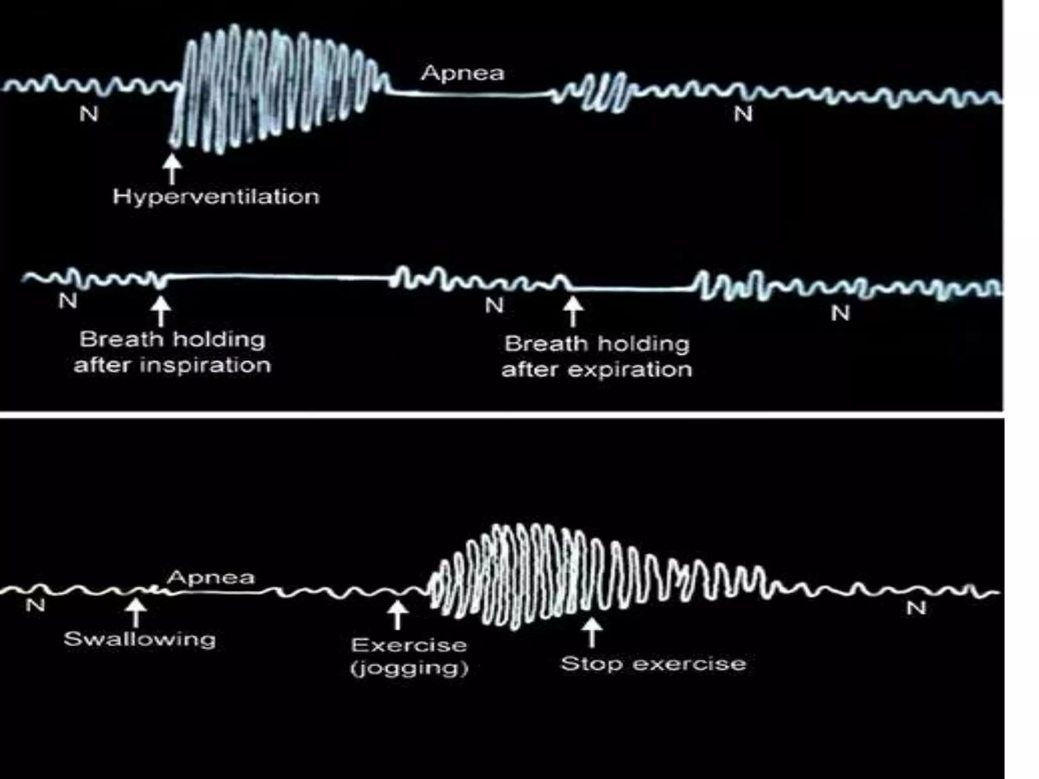 Stethograph- Recording Respiratory Movements | PPTX
