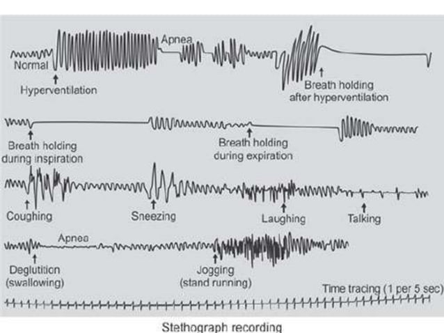 Stethograph- Recording Respiratory Movements | PPTX | Lung and ...
